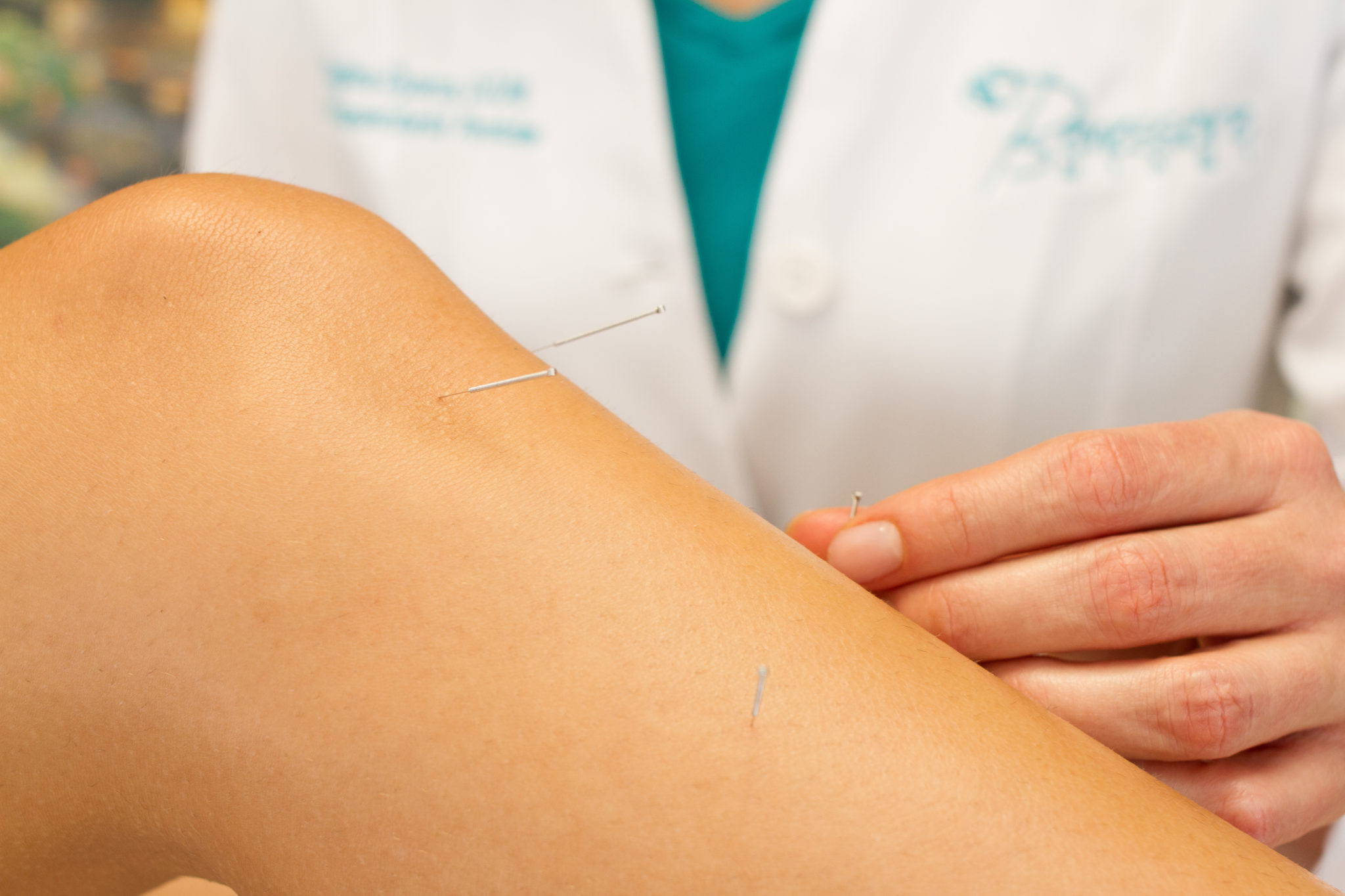 Acupuncture An Effective Treatment for Knee Pain – Benessere Miami ...